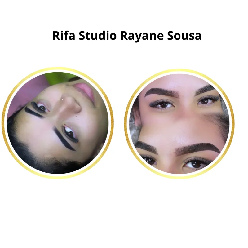 PROCEDIMENTOS NO STUDIO RS